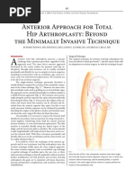 Swashbuckler Approach | PDF