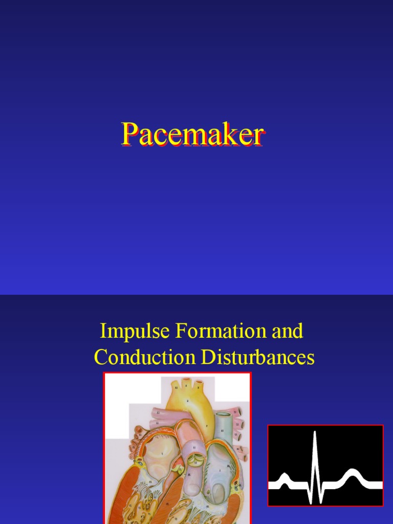 Pacemaker | PDF | Artificial Cardiac Pacemaker | Electrocardiography