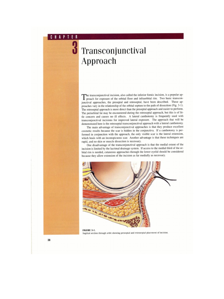 Transconjunctival Approaches | PDF