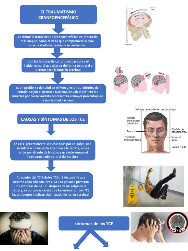 Síntomas y causas del TCE leve | PDF | Lesión cerebral traumática | Lesión