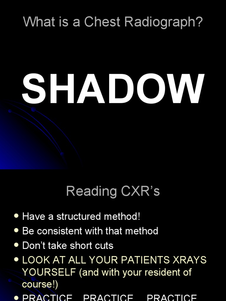 Chest X Ray CXR Basics Mbbs - PPT 111 | PDF
