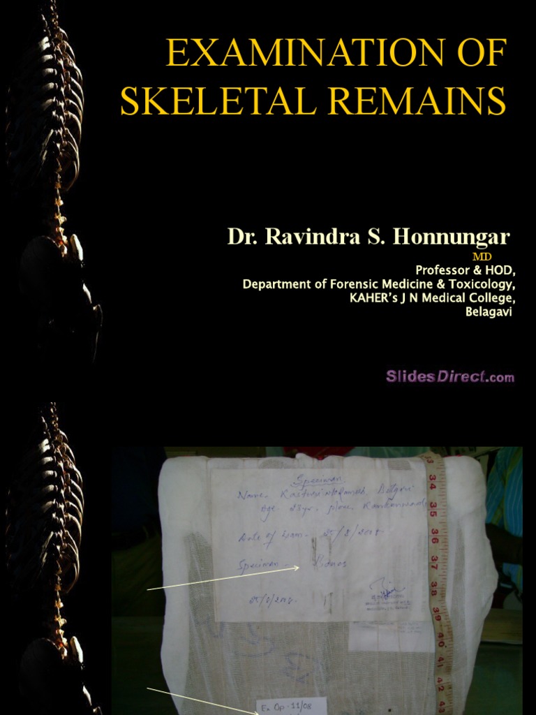 Examination of Skeletal Remains | PDF