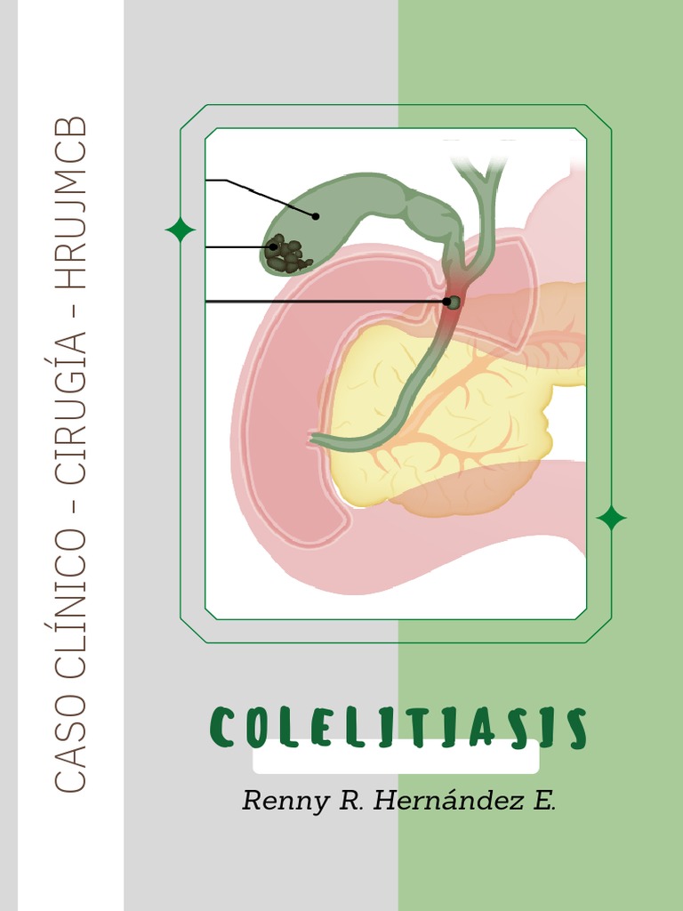 CC Colelitiasis | PDF | Especialidades Medicas | Medicina CLINICA