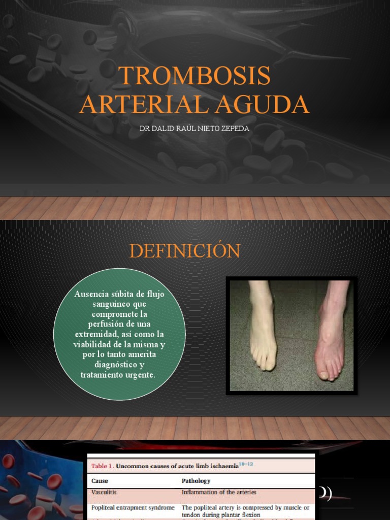 Trombosis Arterial Aguda | PDF | Medicina | Enfermedades vasculares