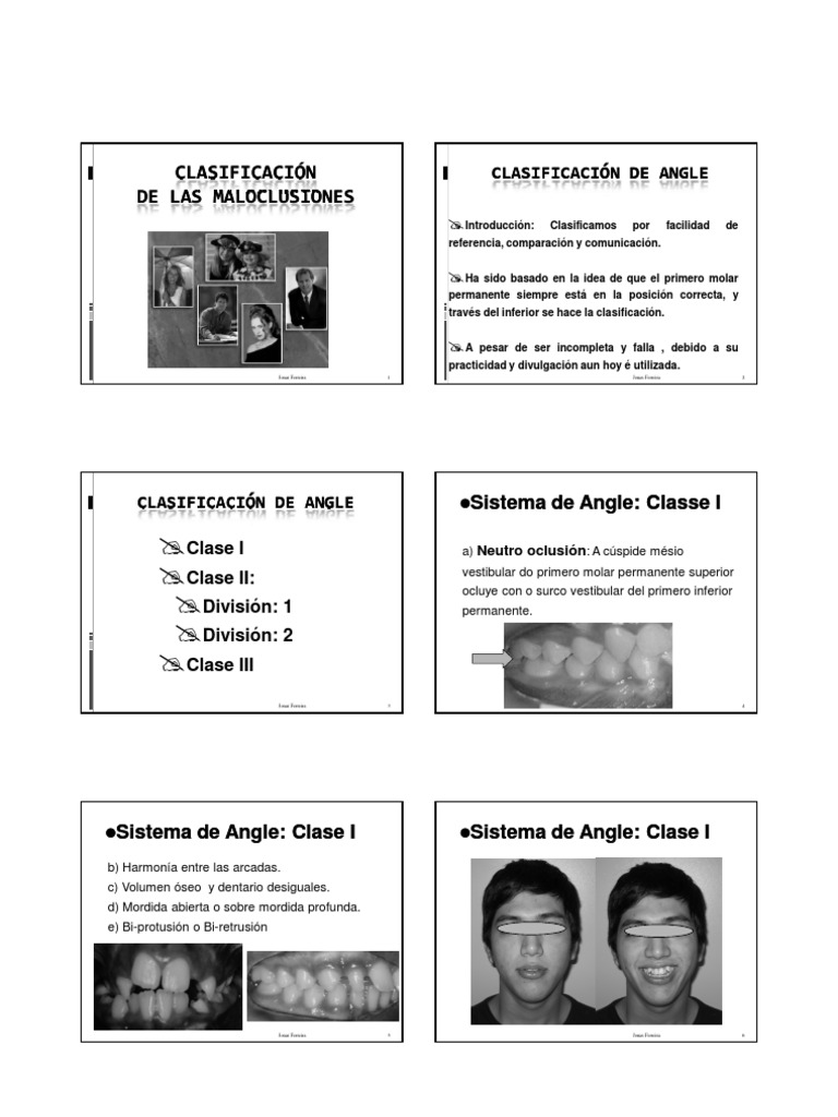 Clasificacion de Angle | PDF