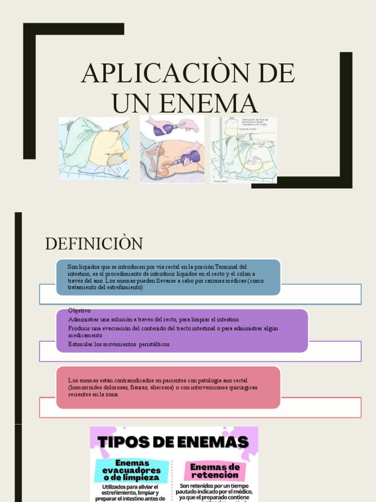 Aplicaciòn de Un Enema | Descargar gratis PDF | Hemorroides | Gastroenterología