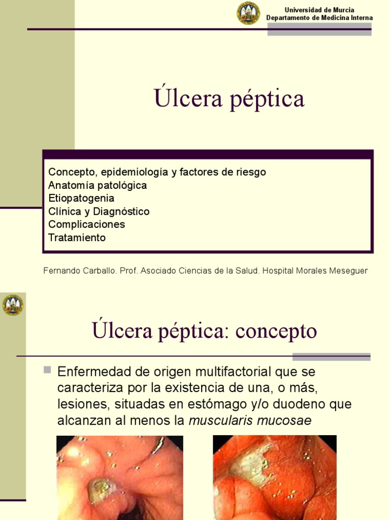Ulcera Péptica | PDF | Gastroenterología | Medicina CLINICA