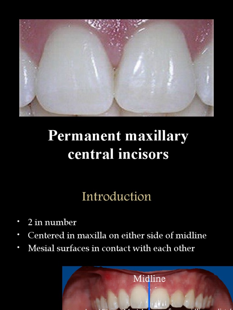 1, Maxillary Permanent Central I | PDF | Dental Anatomy | Tooth