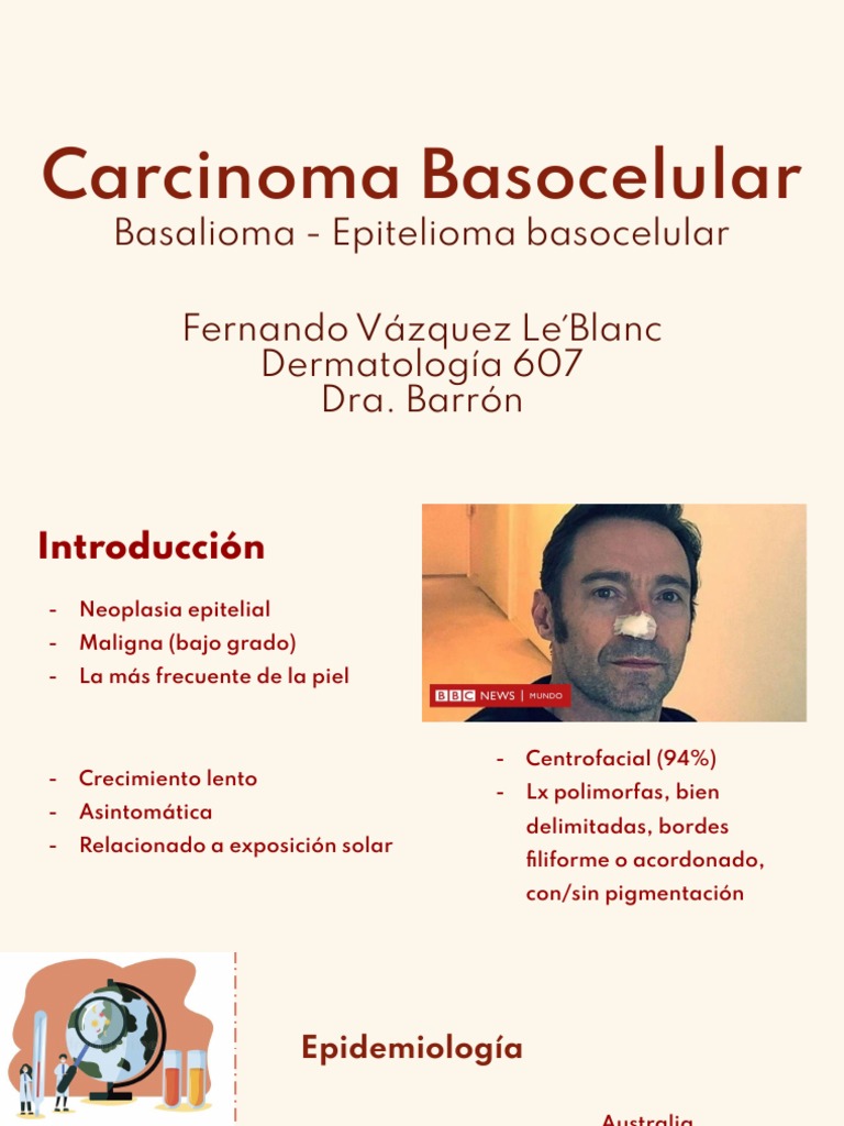 Carcinoma Basocelular | PDF | Cáncer | Medicina