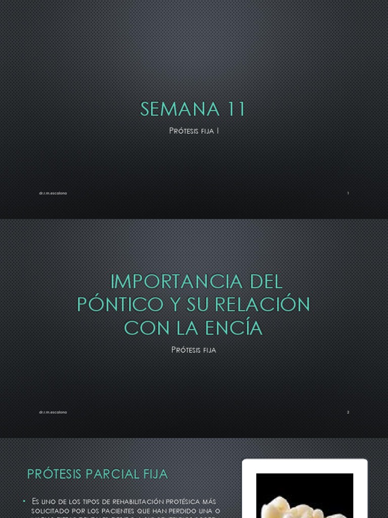 Tipos y funciones del póntico en prótesis fija | PDF | Dentadura ...