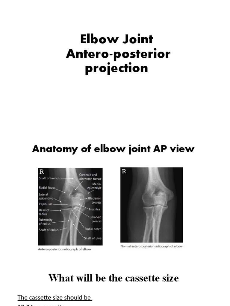 Elbow Joint | PDF