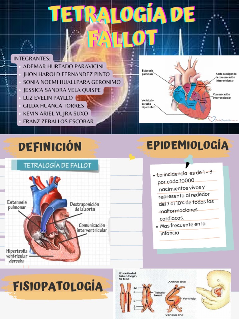 Tetralogía de Fallot | PDF | Ventrículo (corazón) | Corazón