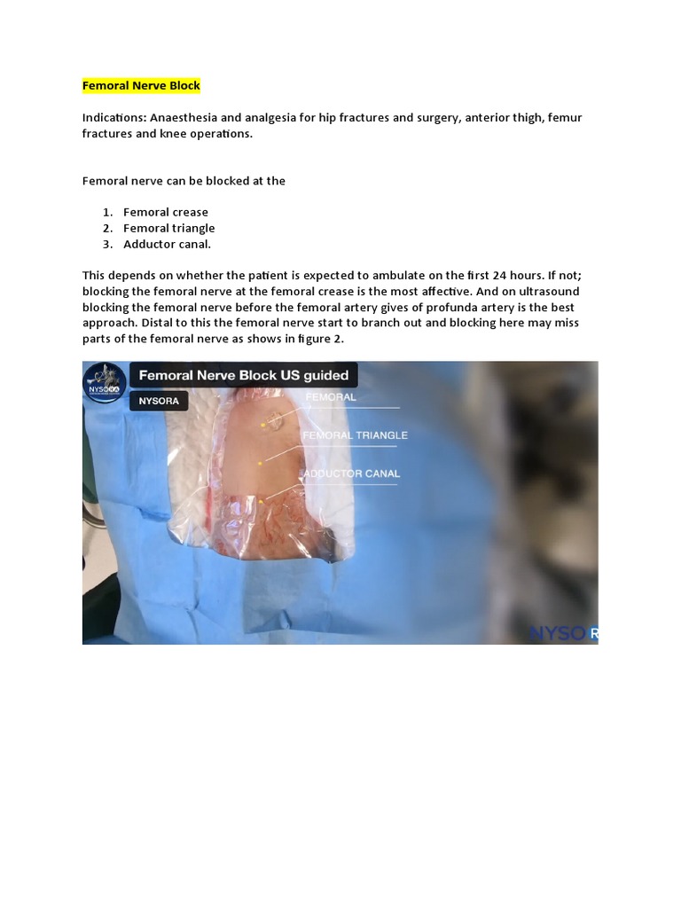 Femoral Nerve Block Techniques | PDF | Science & Mathematics