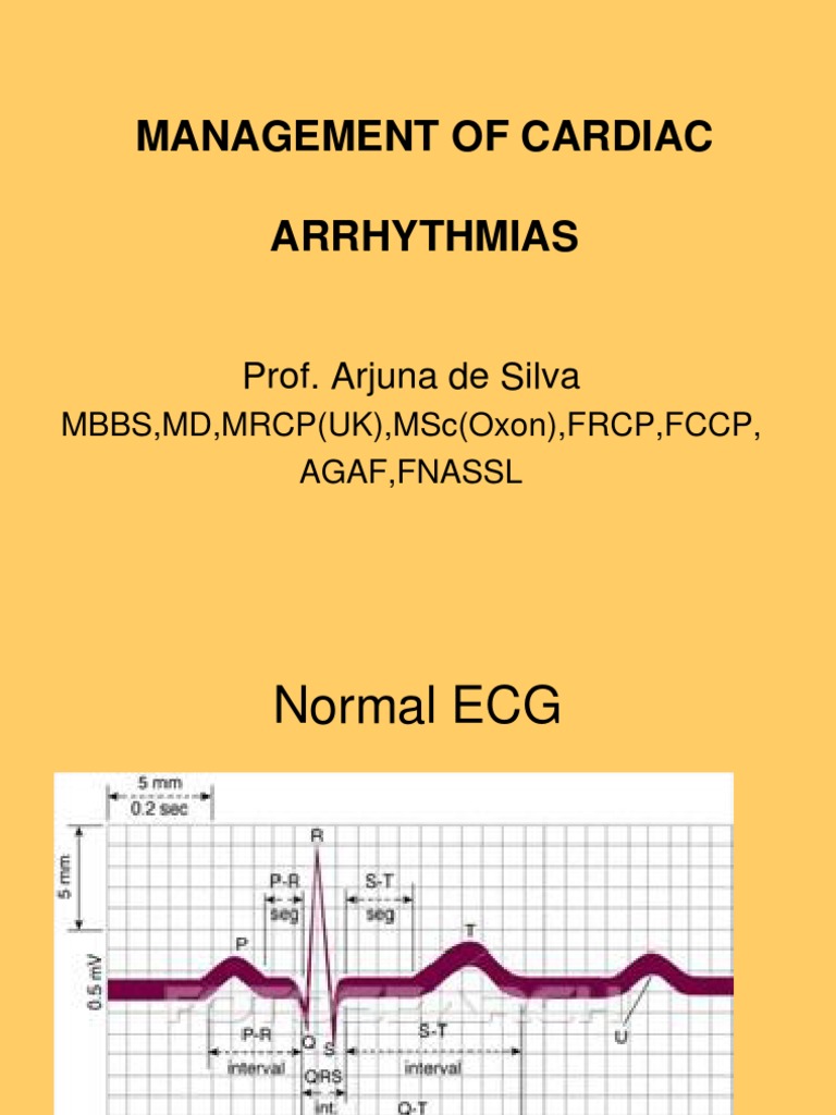 28,29 Management of Cardiac Arrhythmias | Download Free PDF ...