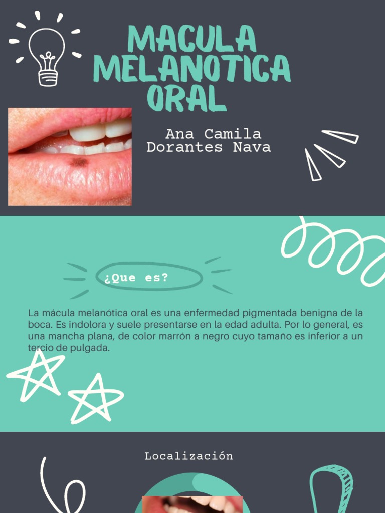Mácula Melanótica Oral | PDF Mácula Melanótica Oral | PDF