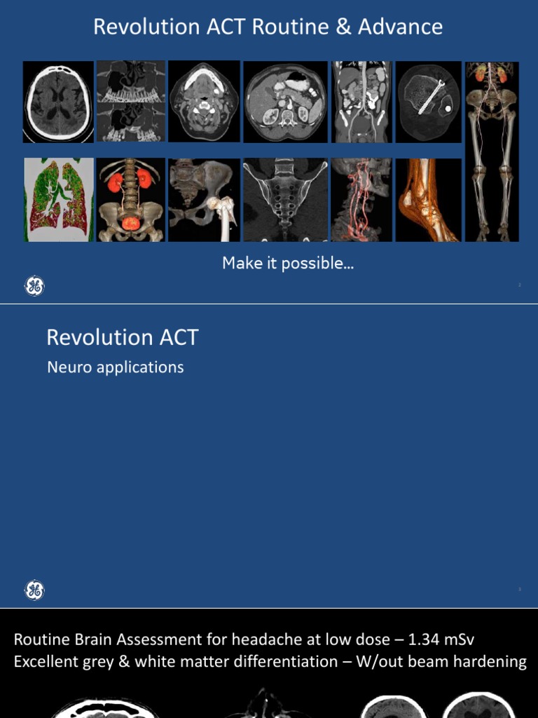 Revolution ACT Clinical Image Gallery | PDF | Ct Scan | Medical Specialties
