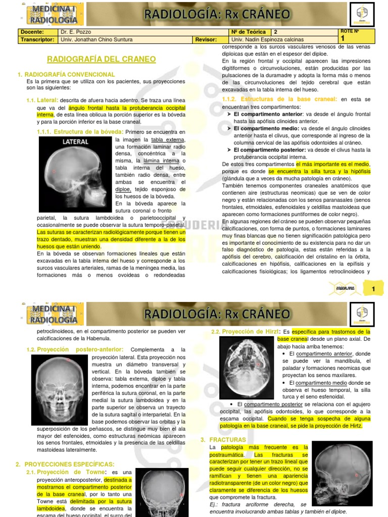 R-R1-T2 Radiografia Del Craneo | PDF | Cráneo | Hueso