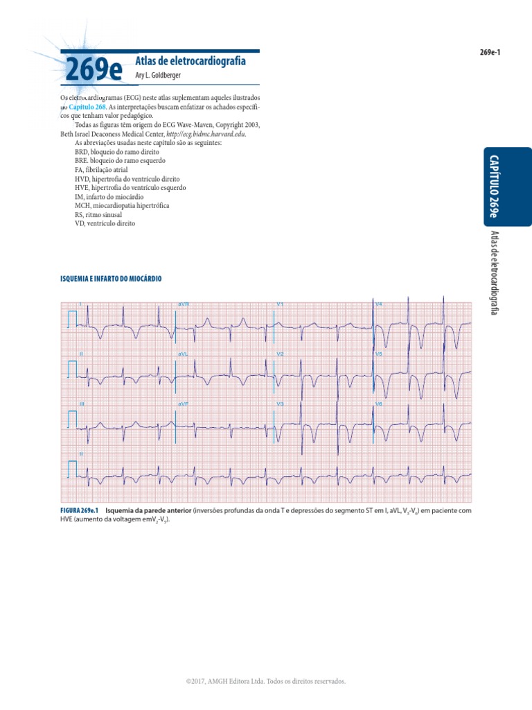 Atlas de ECG | PDF | Eletrocardiografia | Órgão (anatomia)