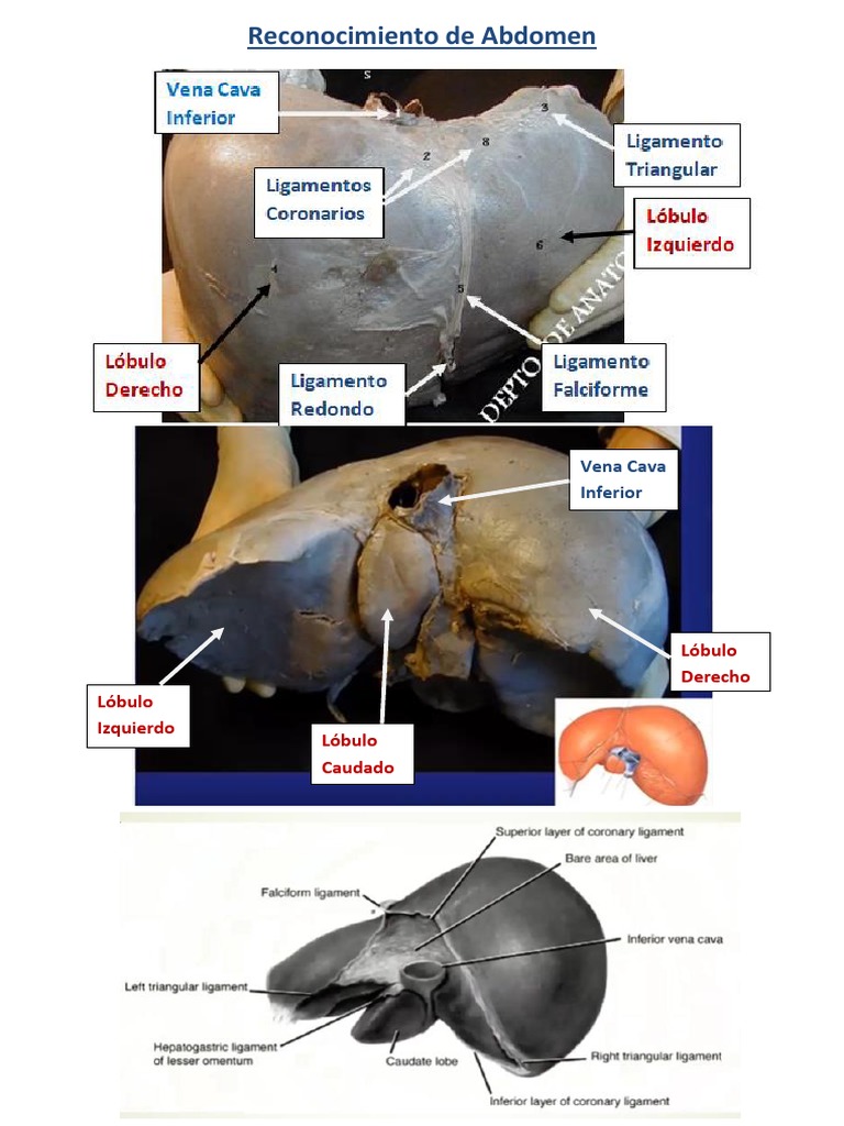 ABDOMEN | PDF | Abdomen | Intestino grueso