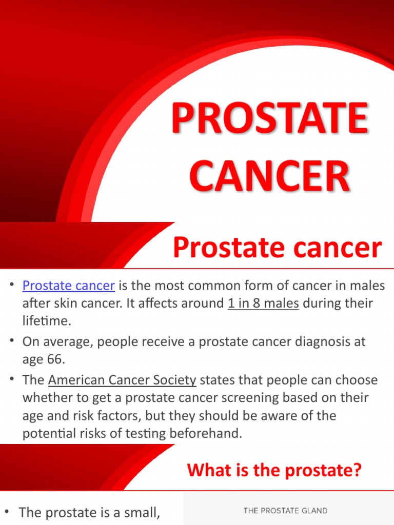 Understanding Prostate Cancer Risks | PDF | Prostate | Urination