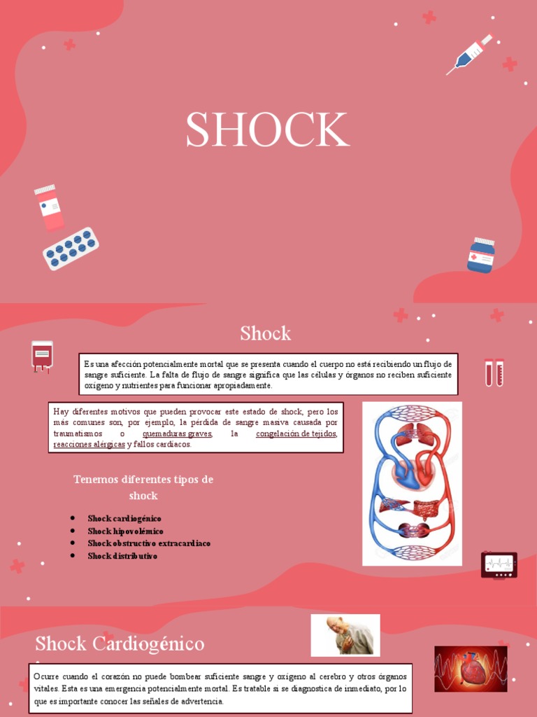 Tipos de Shock | PDF | Corazón | Sangre