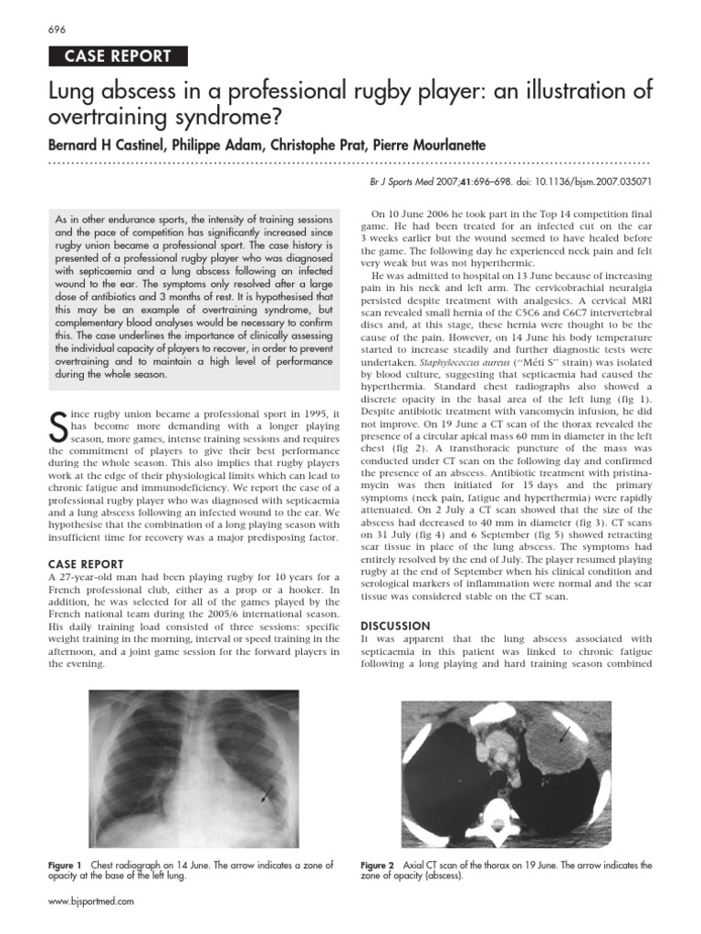 2007 - Lung Abscess in A Professional Rugby Player - Castinel Et Al ...
