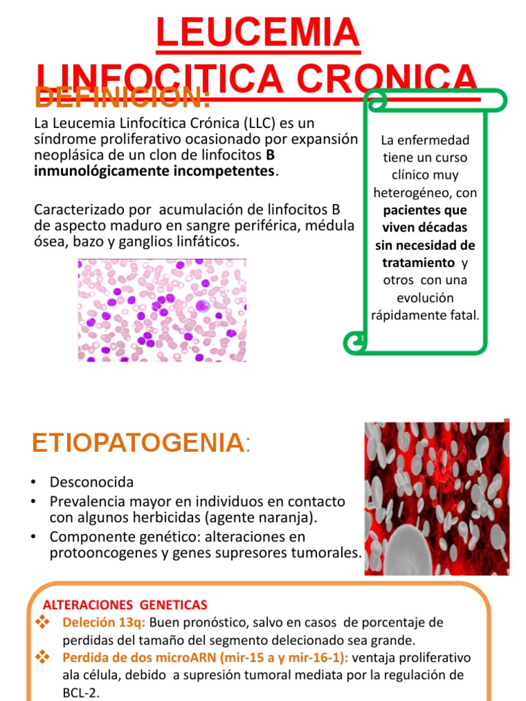 Leucemia Linfocitica Cronica | PDF | Linfocitos | Leucemia
