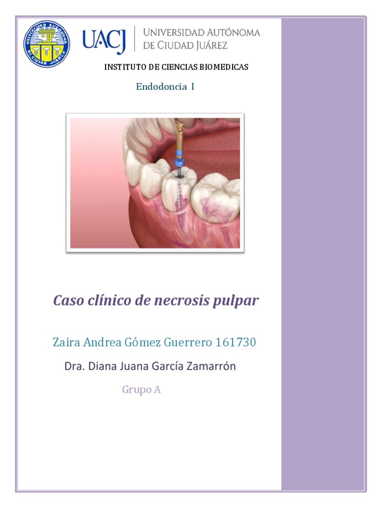 Caso Clínico: Necrosis Pulpar en Endodoncia | PDF