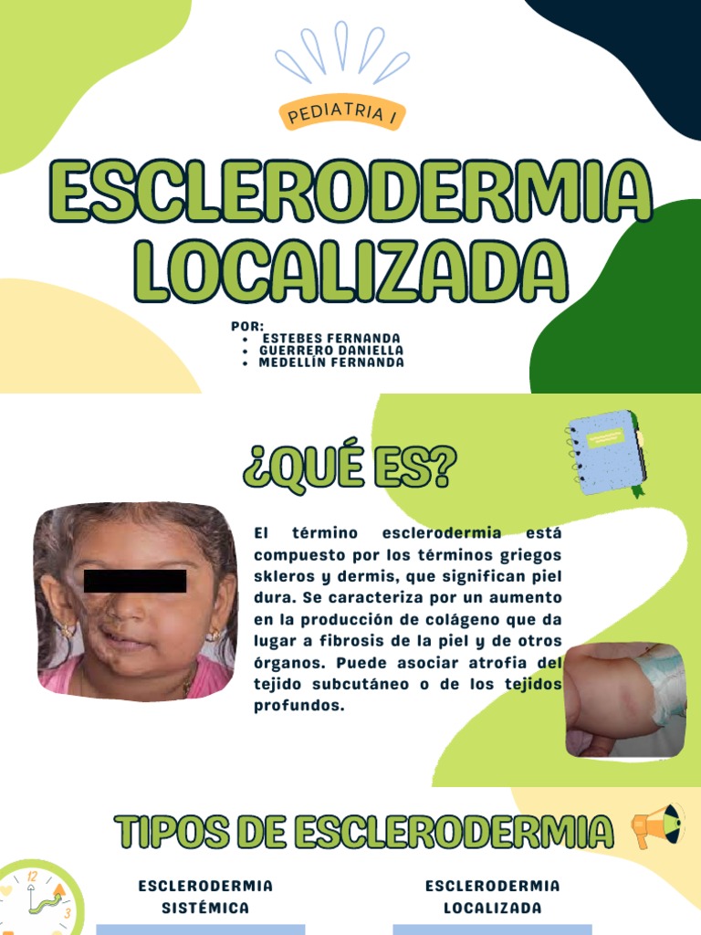Esclerodermia Localizada | PDF