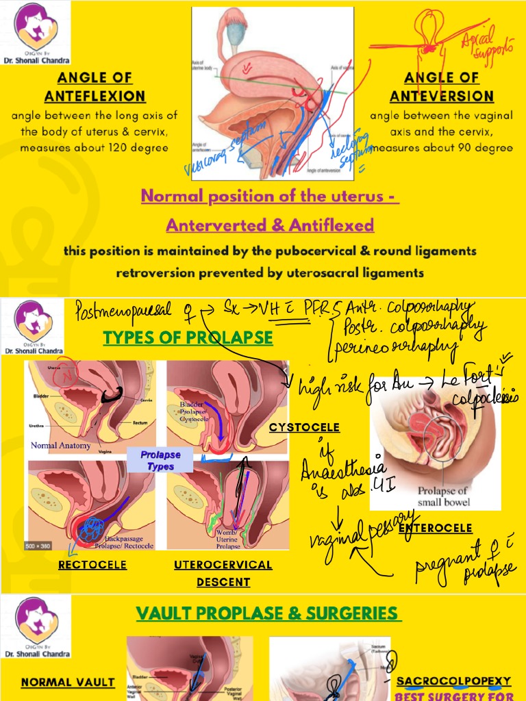 Prolapse Pdf