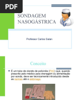 Passagem de Sonda Nasogástrica Na Prática | PDF | Enfermagem | Estômago