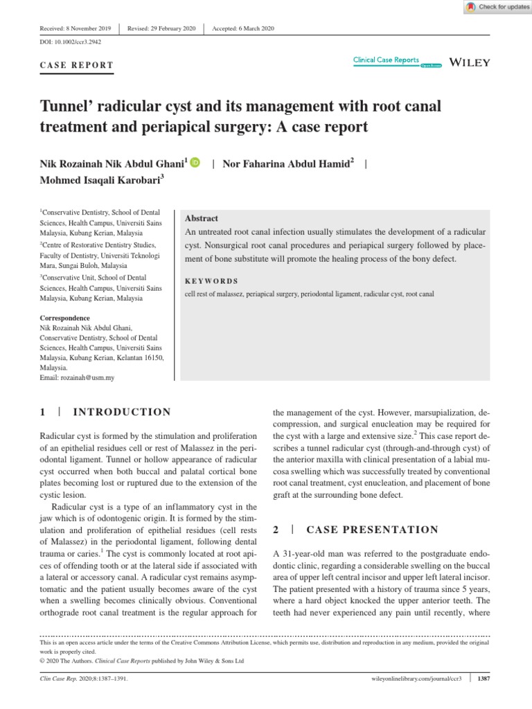 Clinical Case Reports - 2020 - Nik Abdul Ghani - Tunnel Radicular Cyst and Its Management With ...