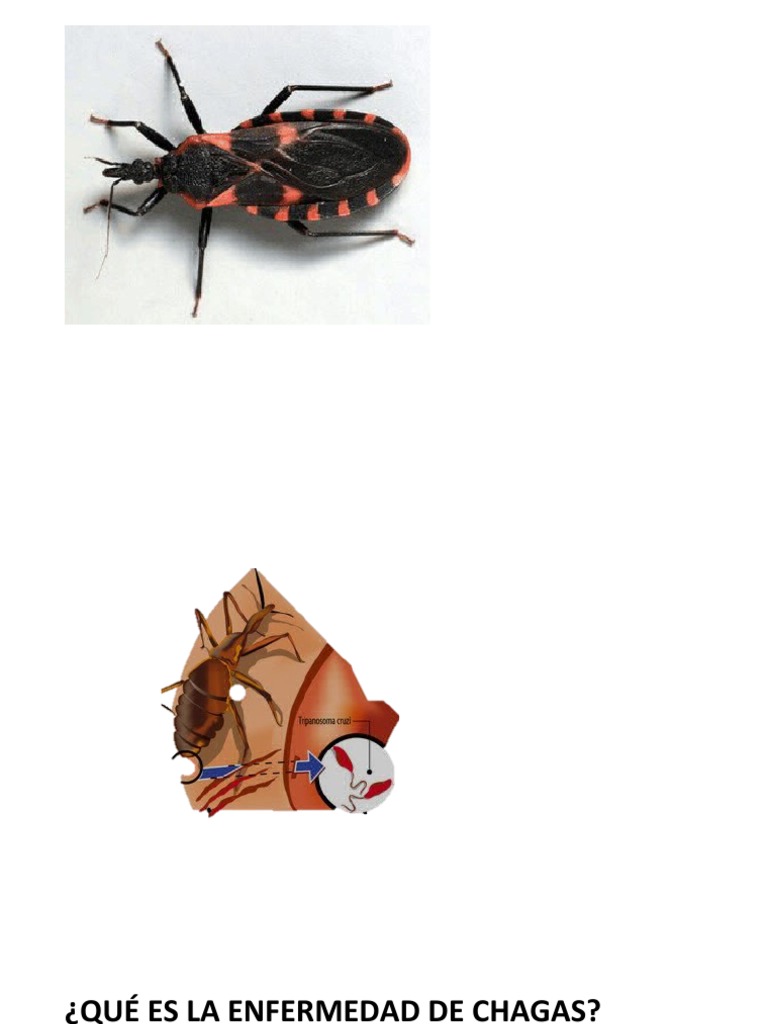 Qué Es La Enfermedad de Chagas | PDF | Ciencias de la Salud | Inmunología