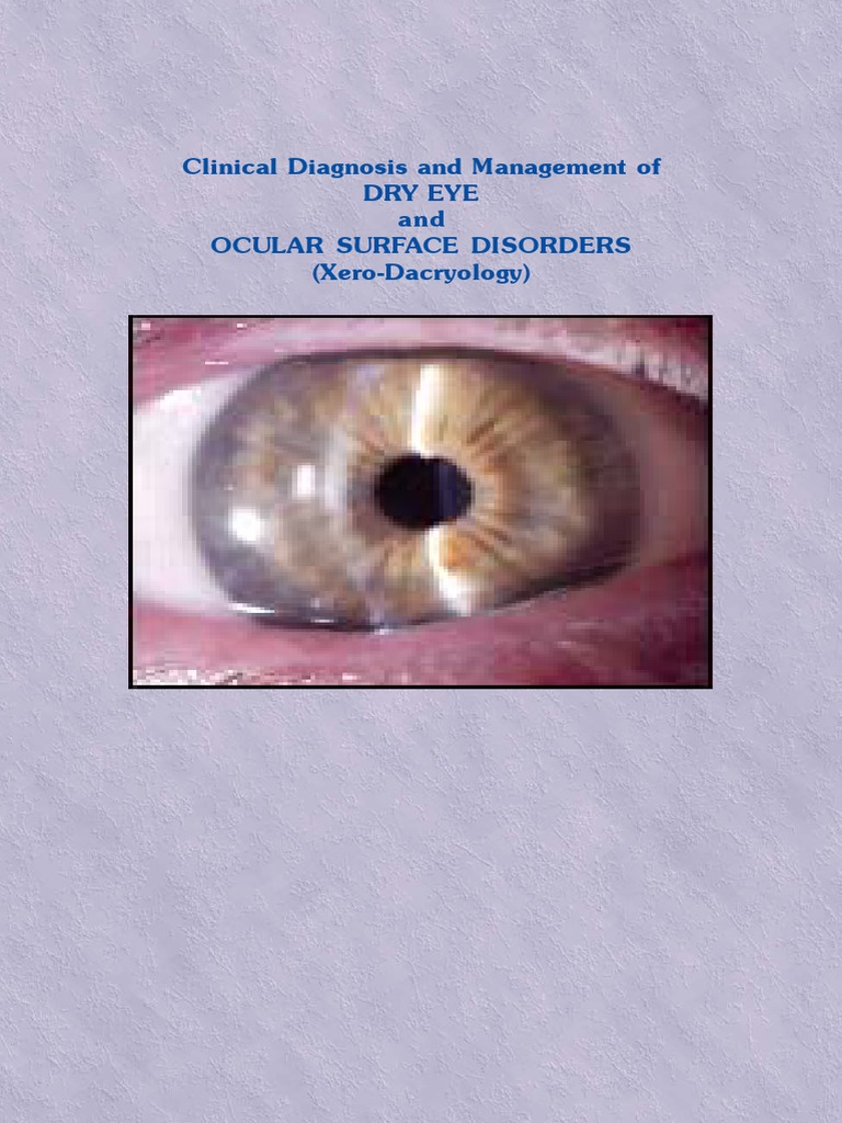 Clinical Diagnosis and Management of Dry Eye and Ocular Surface | PDF ...