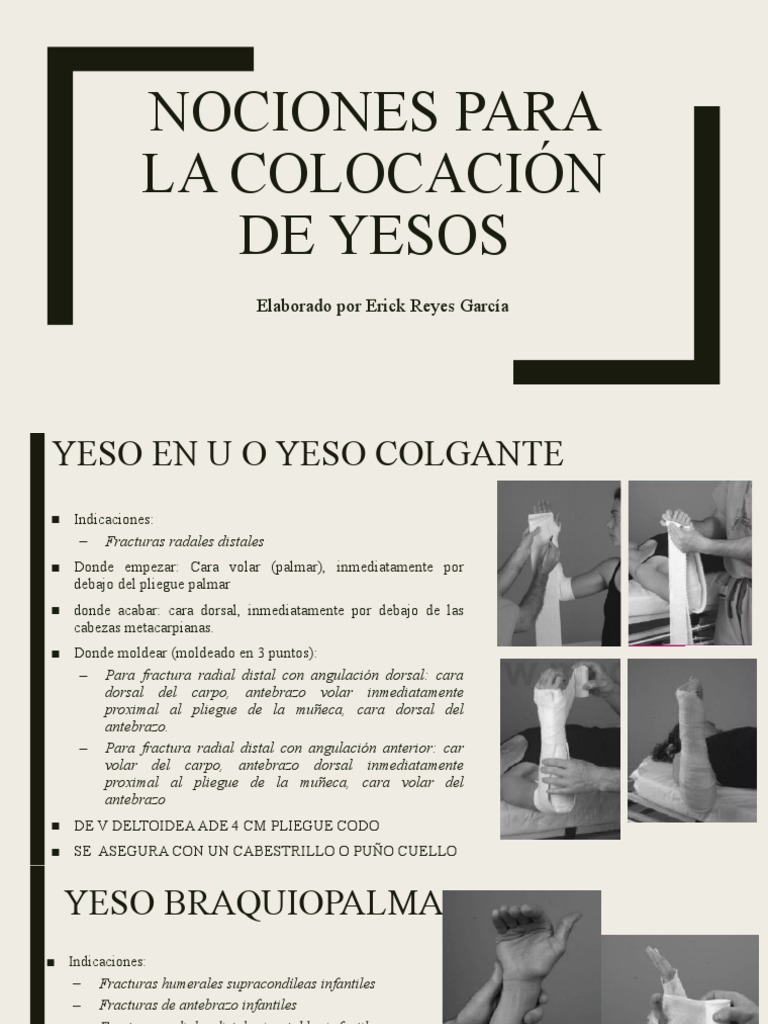 Yesos GRG | PDF | Tobillo | Mano