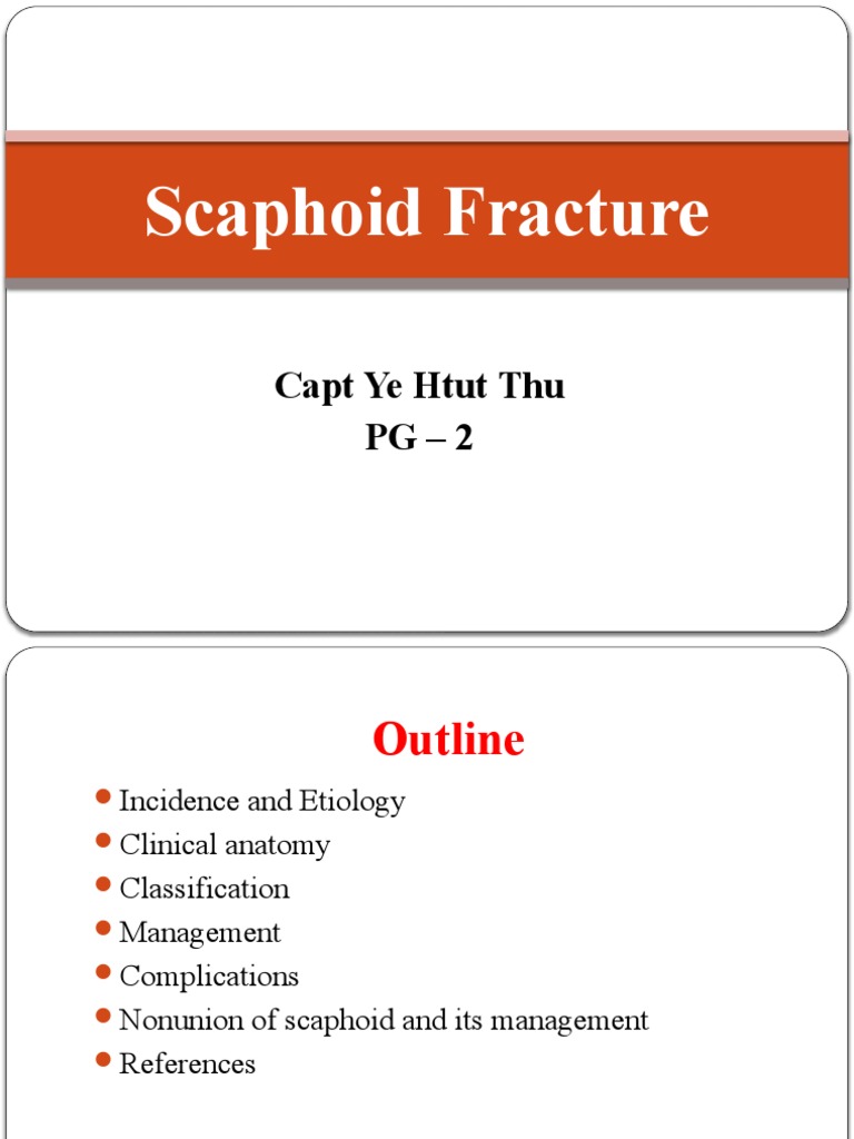 Scaphoid Fracture (YHT) | PDF | Musculoskeletal System | Hand