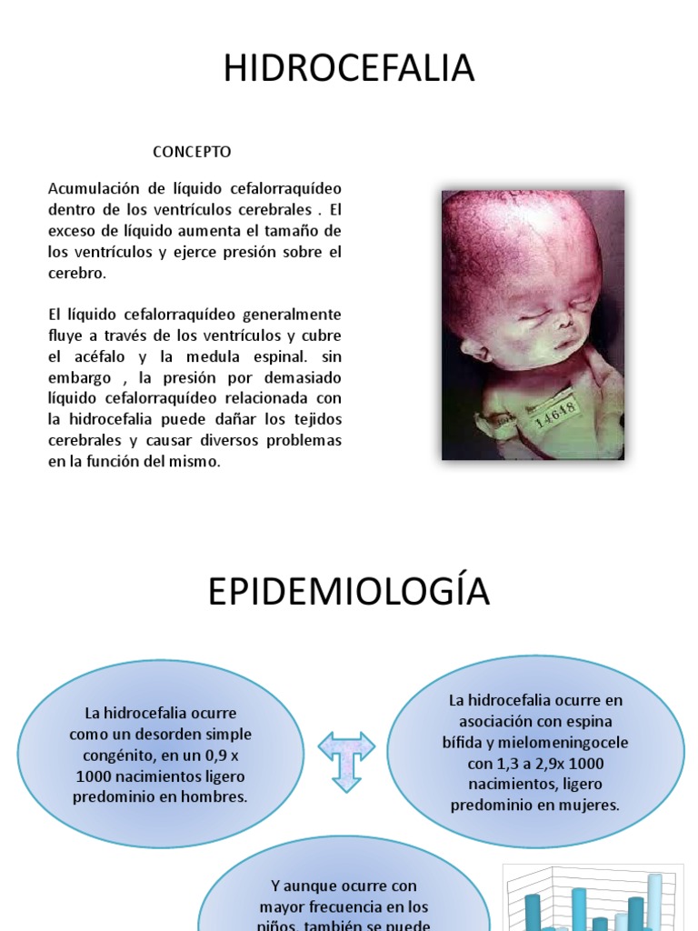 HIDROCEFALIA | PDF | Fluido cerebroespinal | Medicina CLINICA