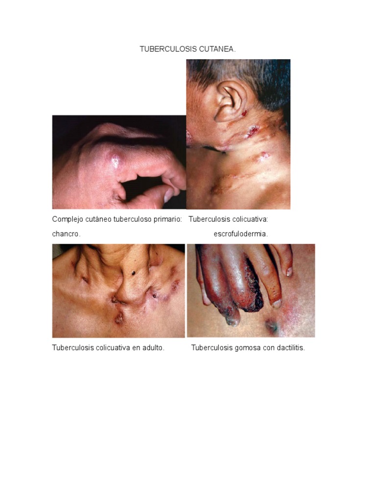Imagenes Dermato 2 | PDF