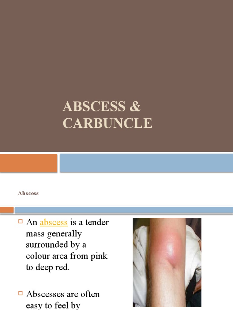 Abscess & Carbuncle | PDF