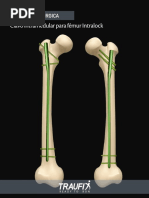 Protesis de Thompson Espanol SCECLE | PDF | Cirugía | Medicina CLINICA