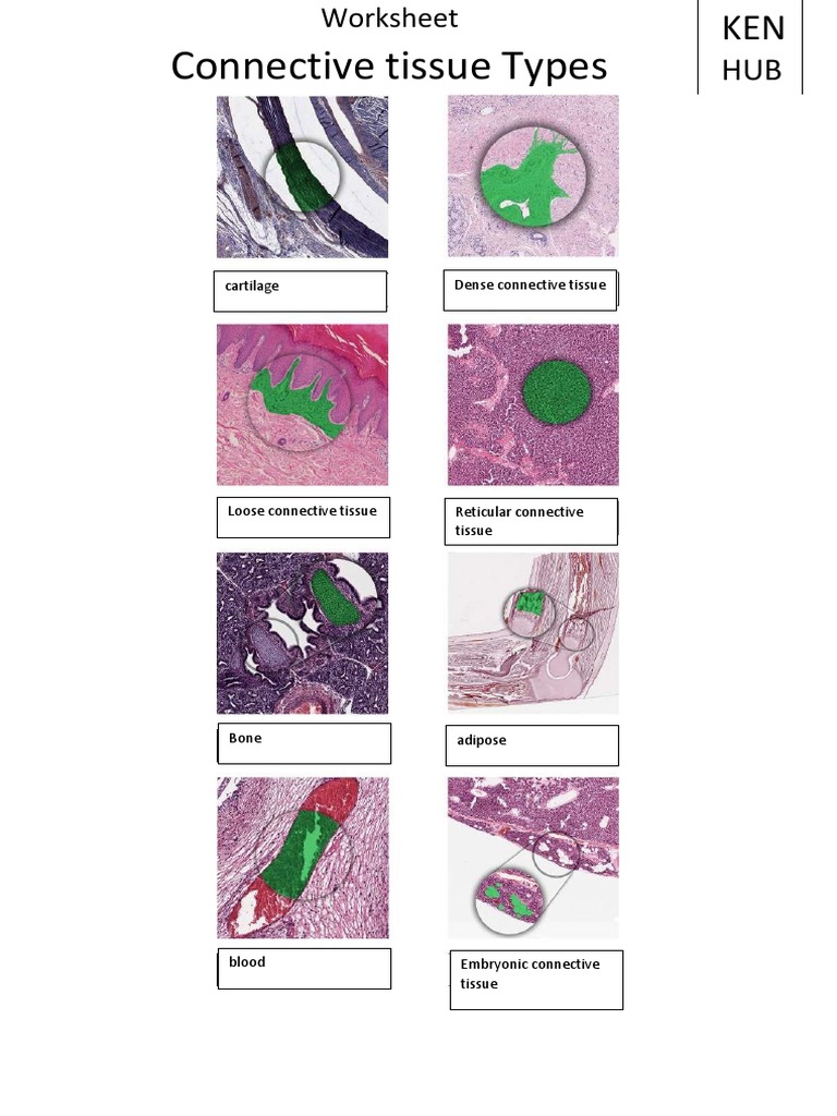 Connective Tissue Blank Answers | PDF