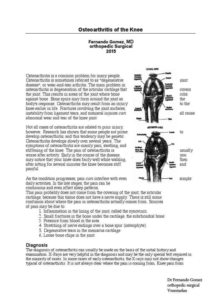 Osteoarthritis of The Knee-1 | PDF