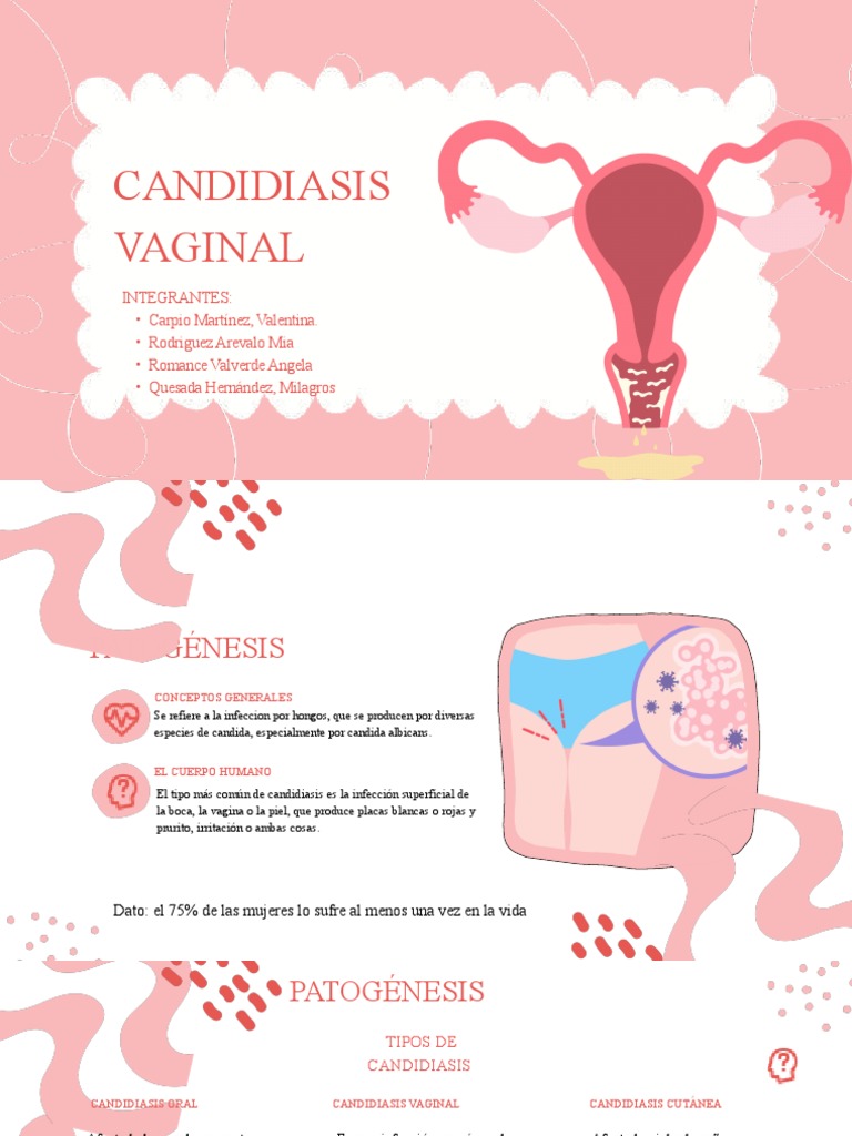 CANDIDIASIS VAGINAL | PDF