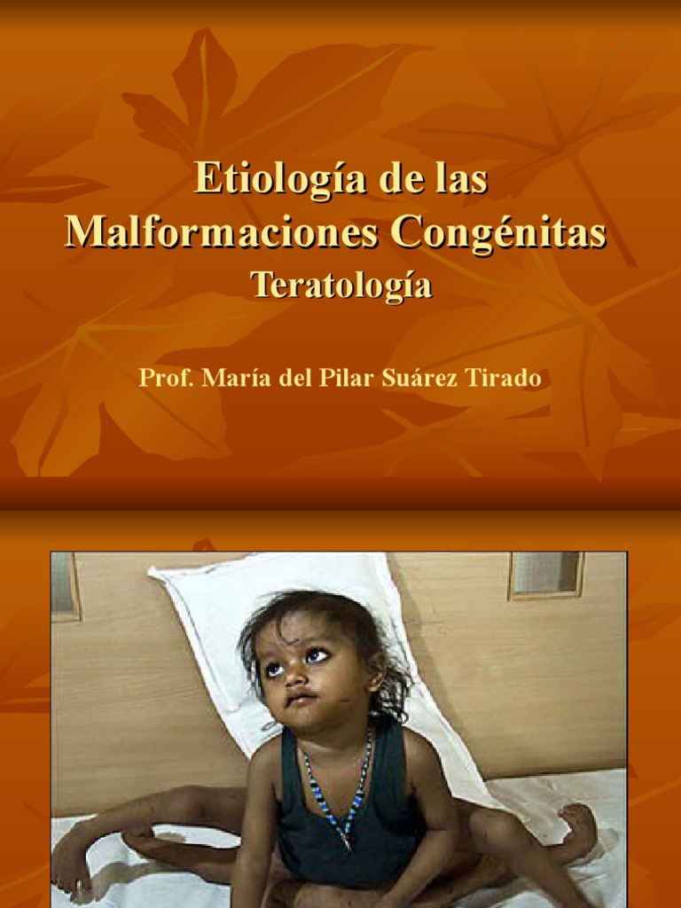 Etiología de Las Malformaciones Congénitas
