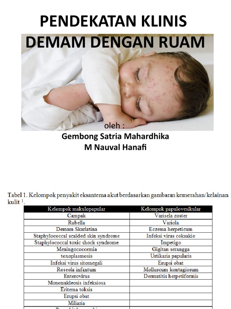 Diagnosis Banding Demam dengan Ruam | PDF