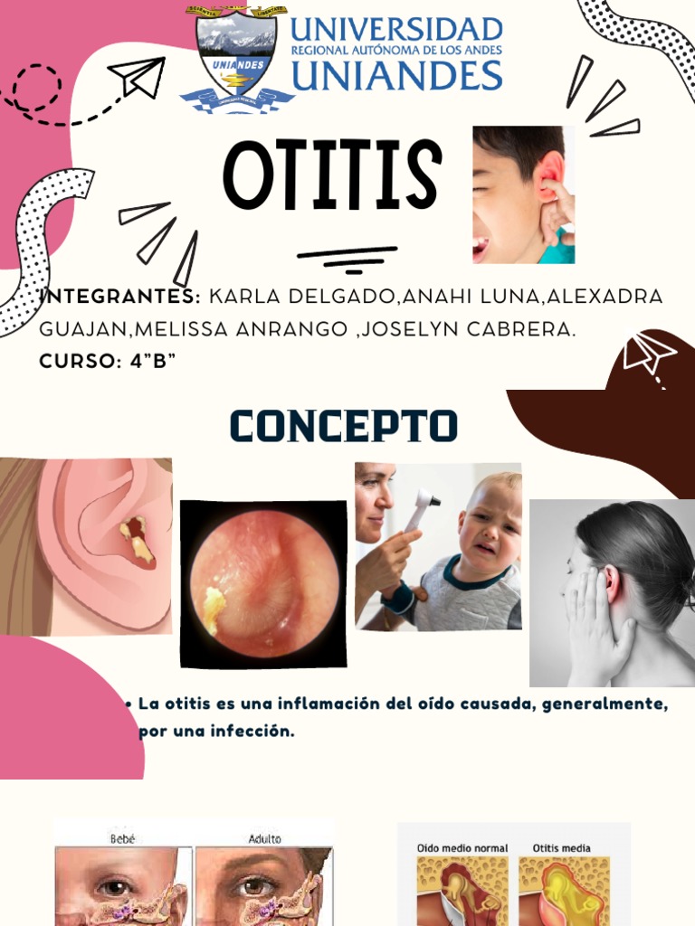 Otitis | PDF