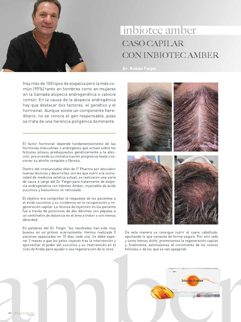 Caso Capilar Con Inbiotec Amber | PDF