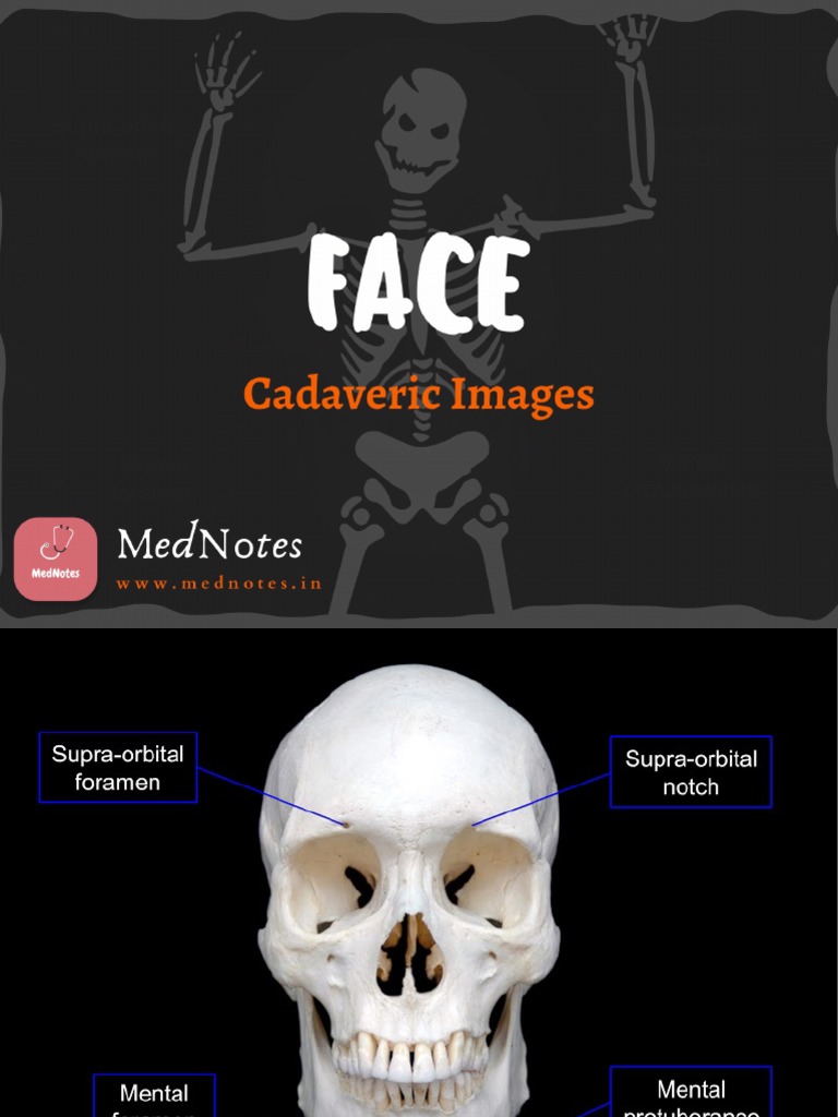 Face Cadaveric Images (Free Version) | PDF