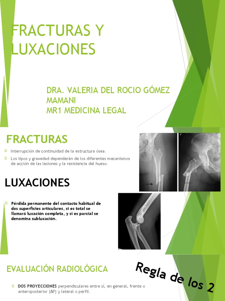 Identificacion de Fracturas y Luxaciones Radio | PDF