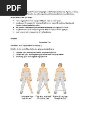 Single Hip Spica Cast